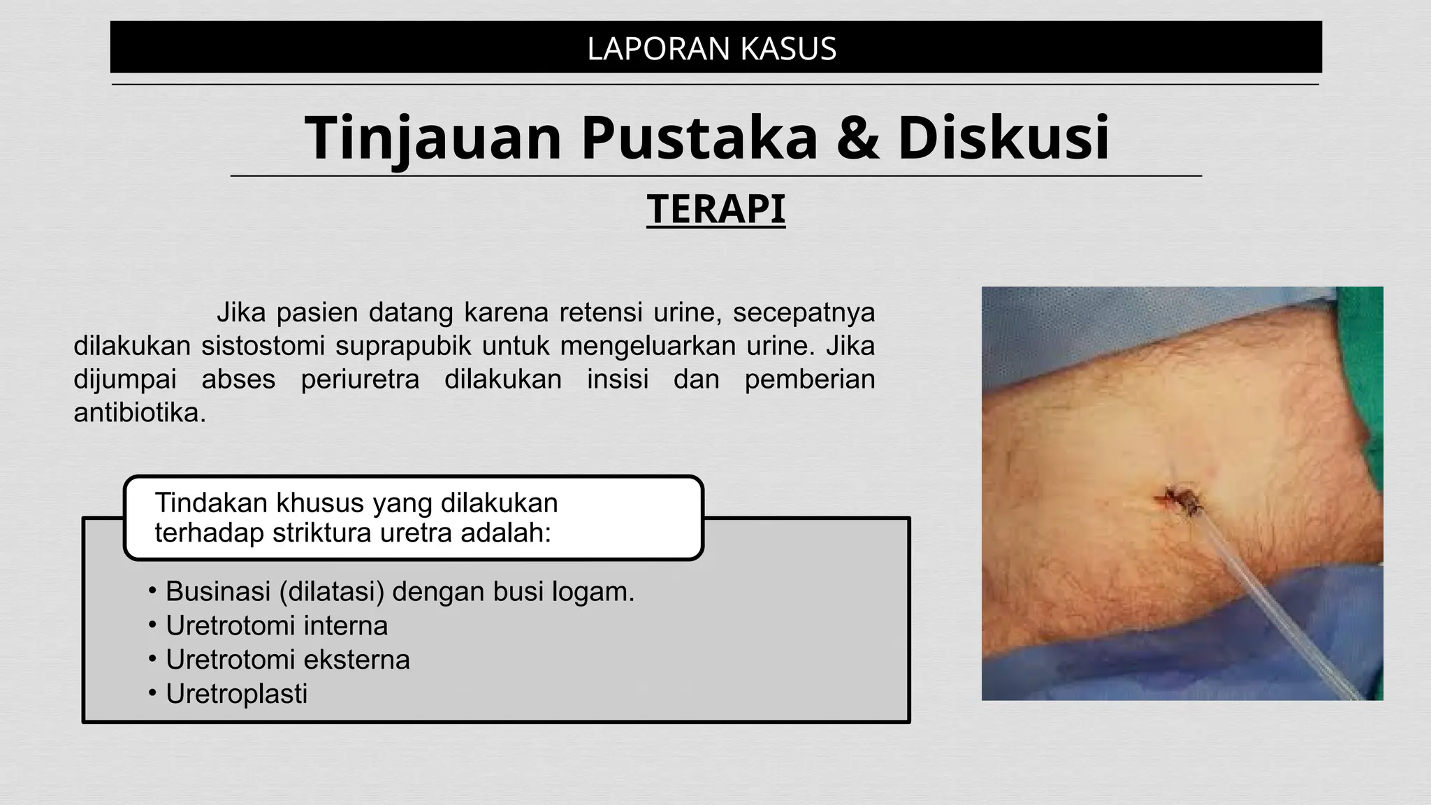 Striktur Urethra bedah urologi power point | PPT