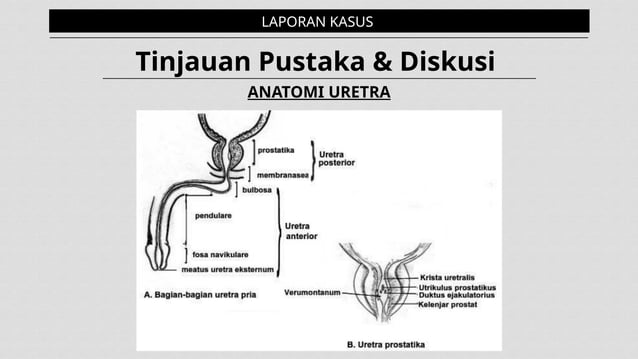 Striktur Urethra bedah urologi power point | PPT