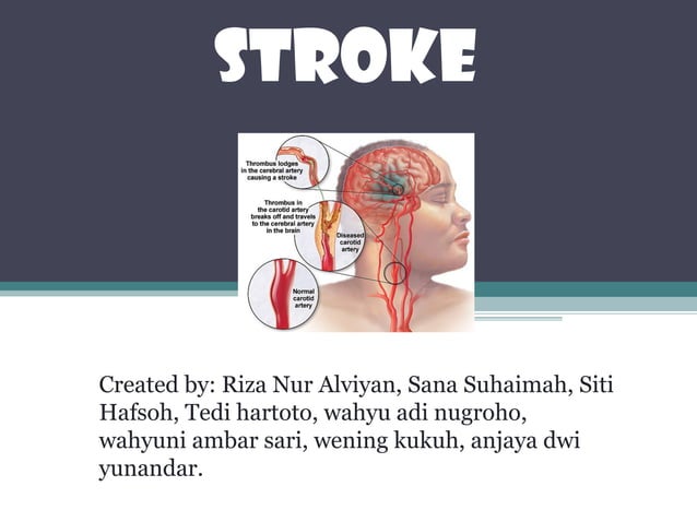 Stroke | PPT