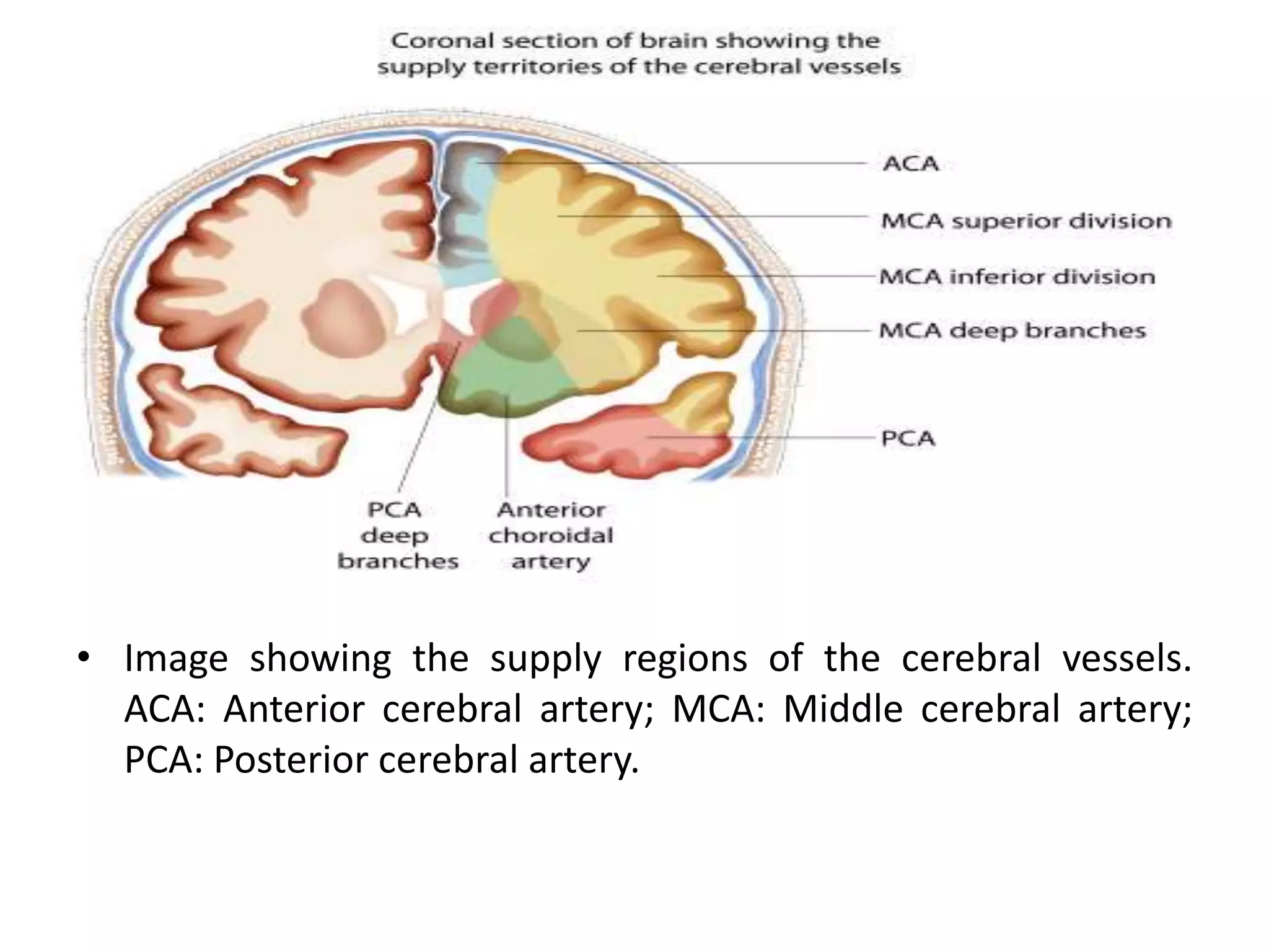 Stroke | PPTX