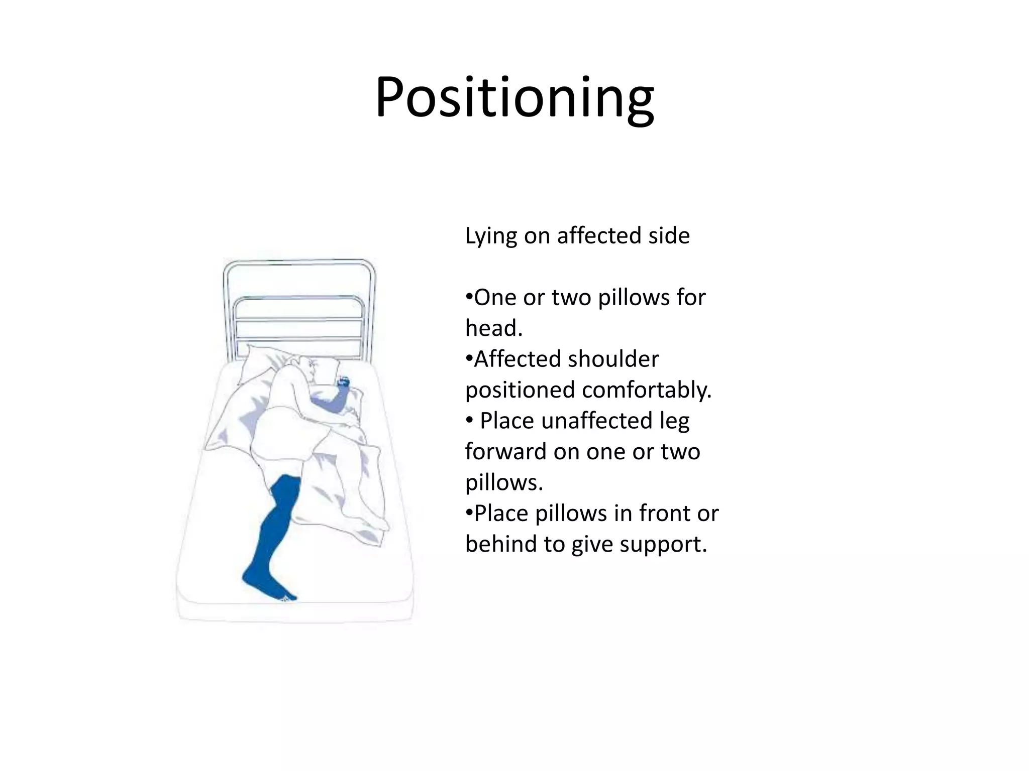 Stroke | PPTX