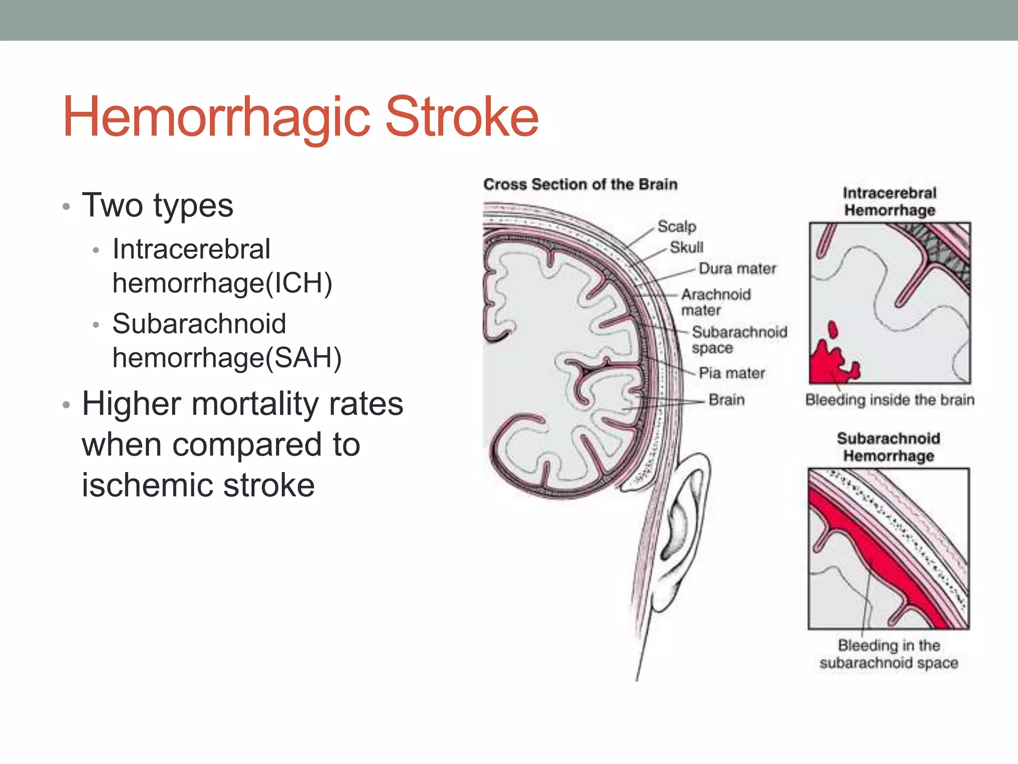 Ischemic and hemorrhagic stroke | PPTX