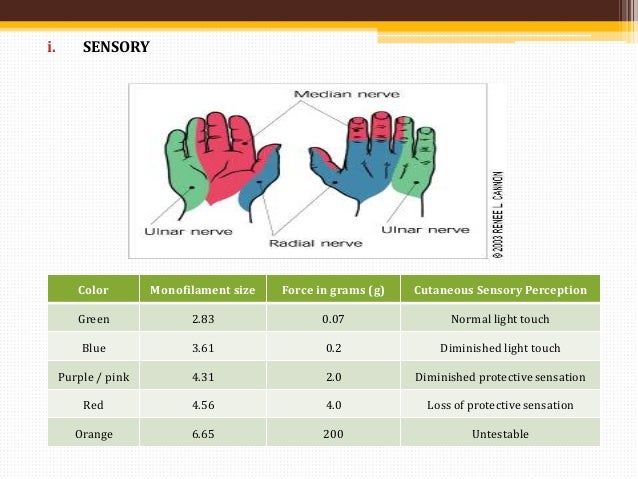 Right MCA Ischemic Stroke with Left Hemiparesis