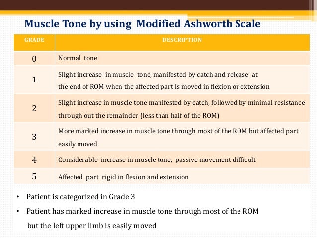 Right MCA Ischemic Stroke with Left Hemiparesis