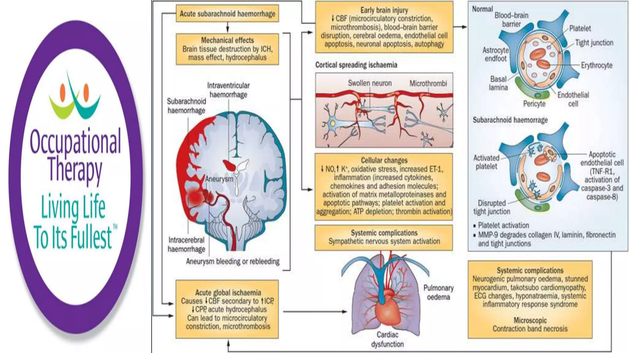 Occupational Therapy and Stroke | PPTX