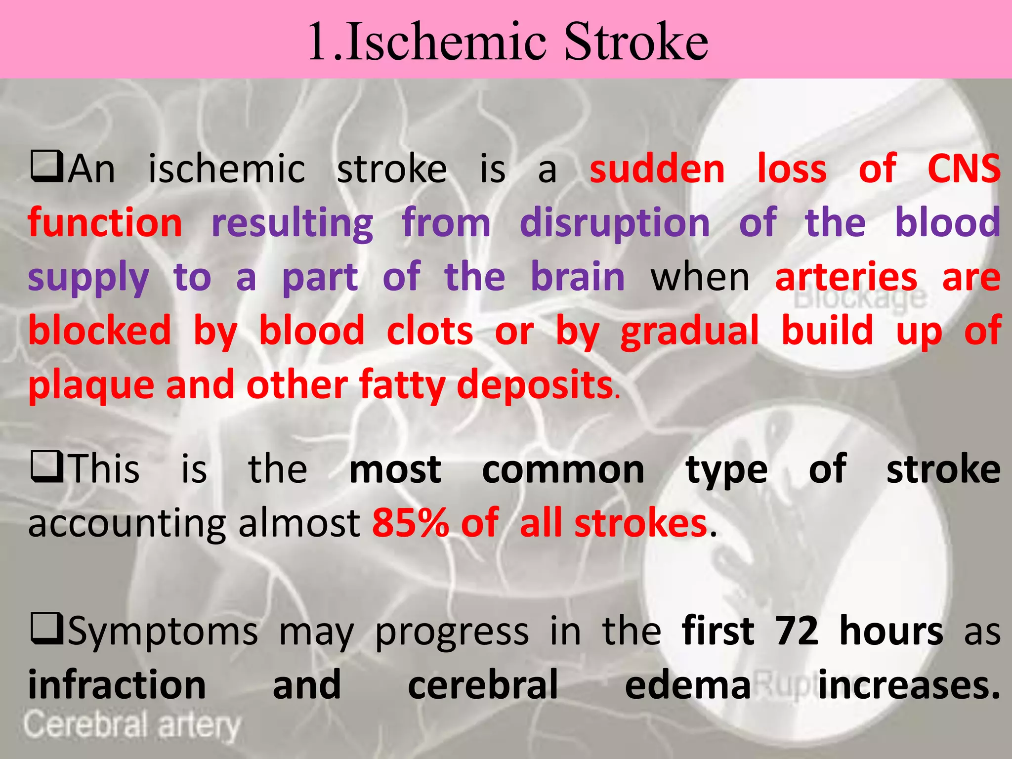 Stroke | PPT