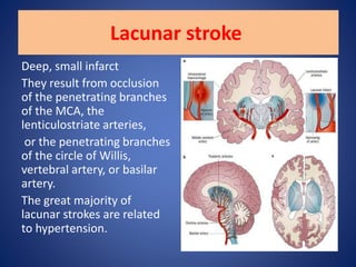 Stroke | PPTX | Brain and Nervous System Disorders | Diseases and ...