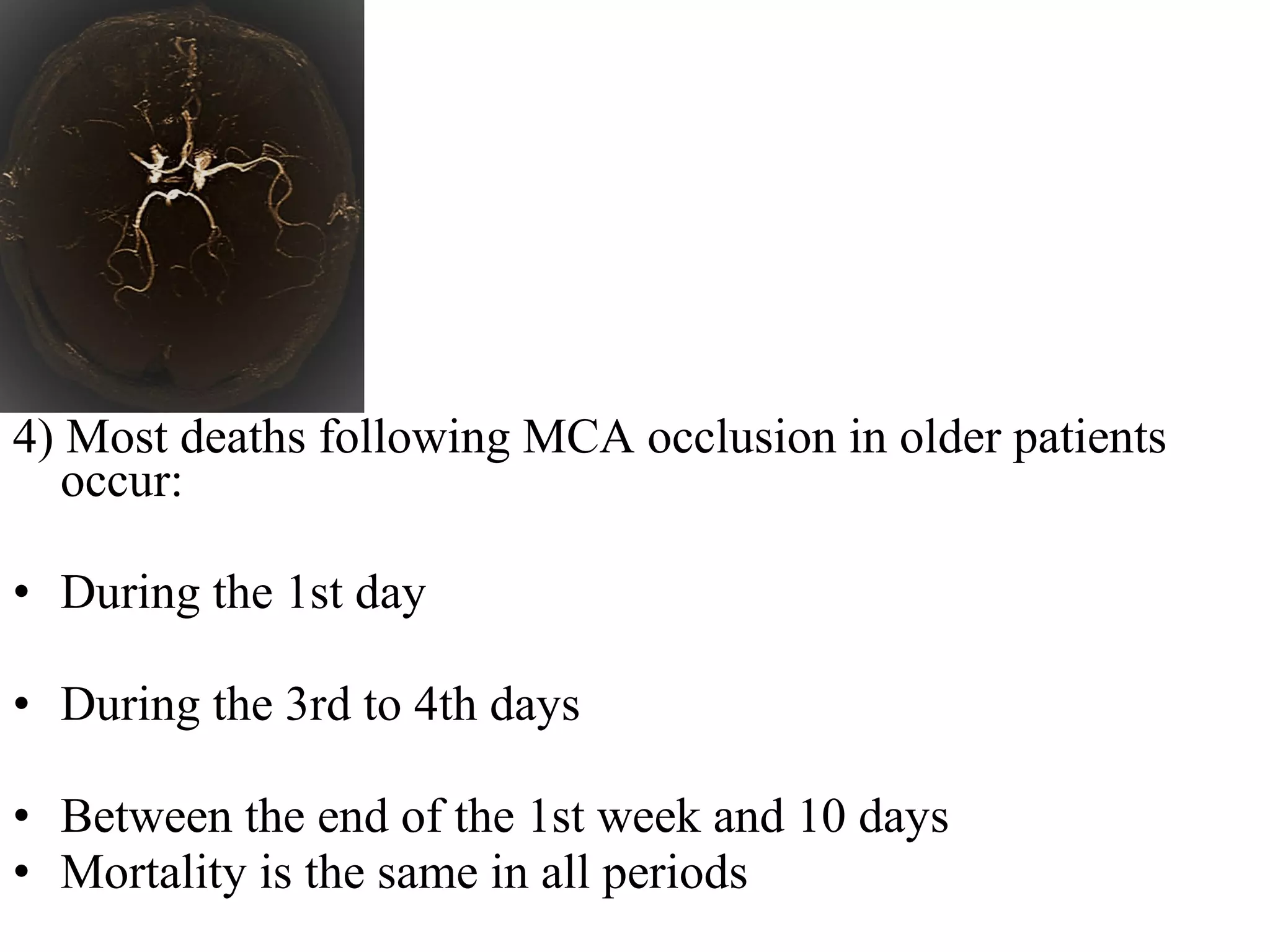 Stroke Quiz | PPT | Brain and Nervous System Disorders | Diseases and ...