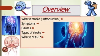 Stroke | PPT
