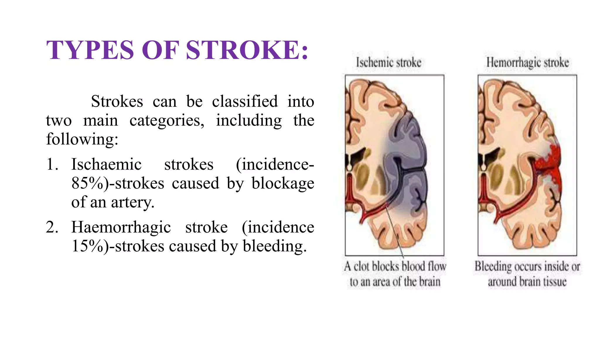 Classification, Pathophysiology and management of Brain Stroke for Pharm.D (Pharmacotherapeutics ...