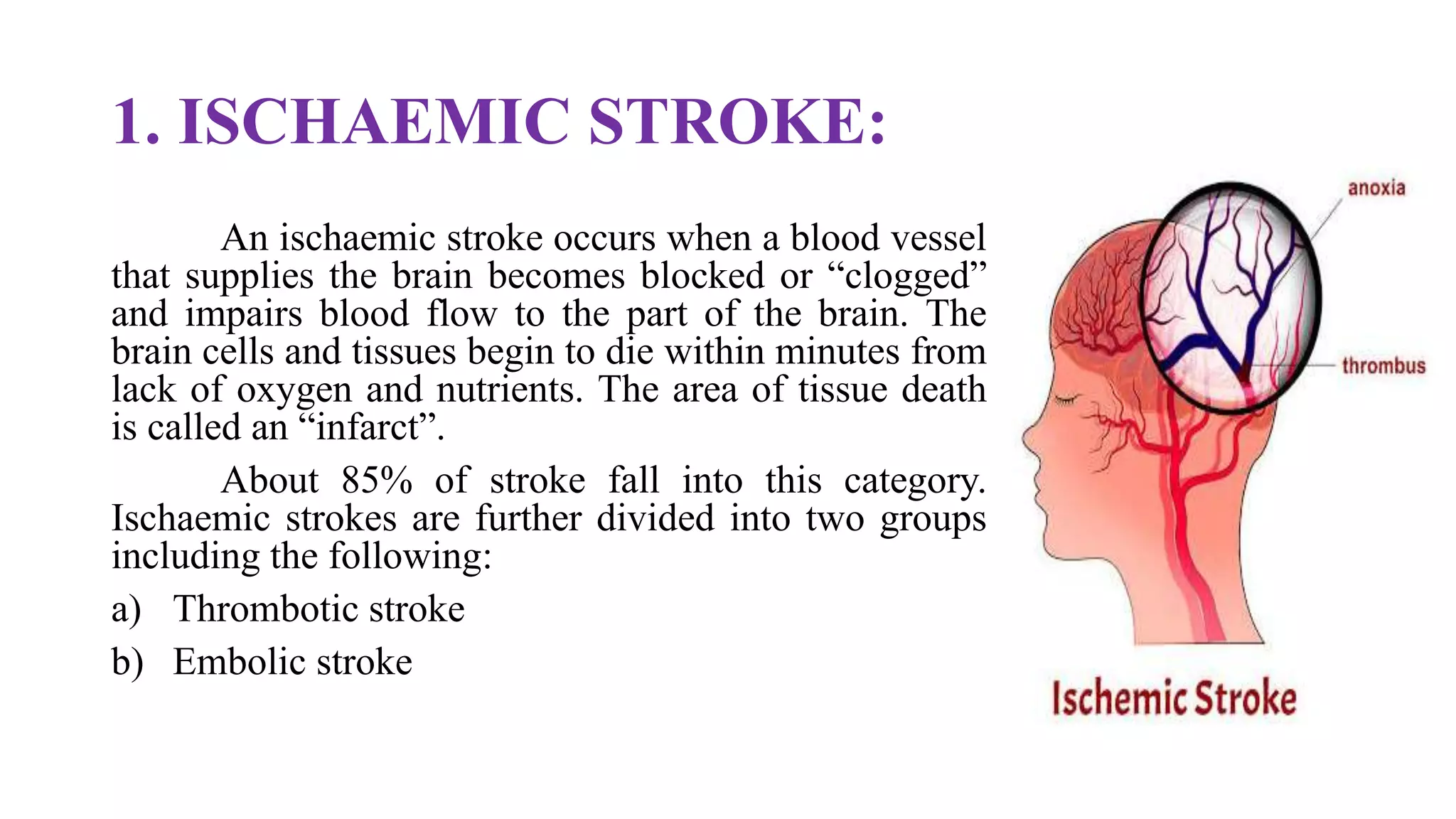 Classification, Pathophysiology and management of Brain Stroke for ...