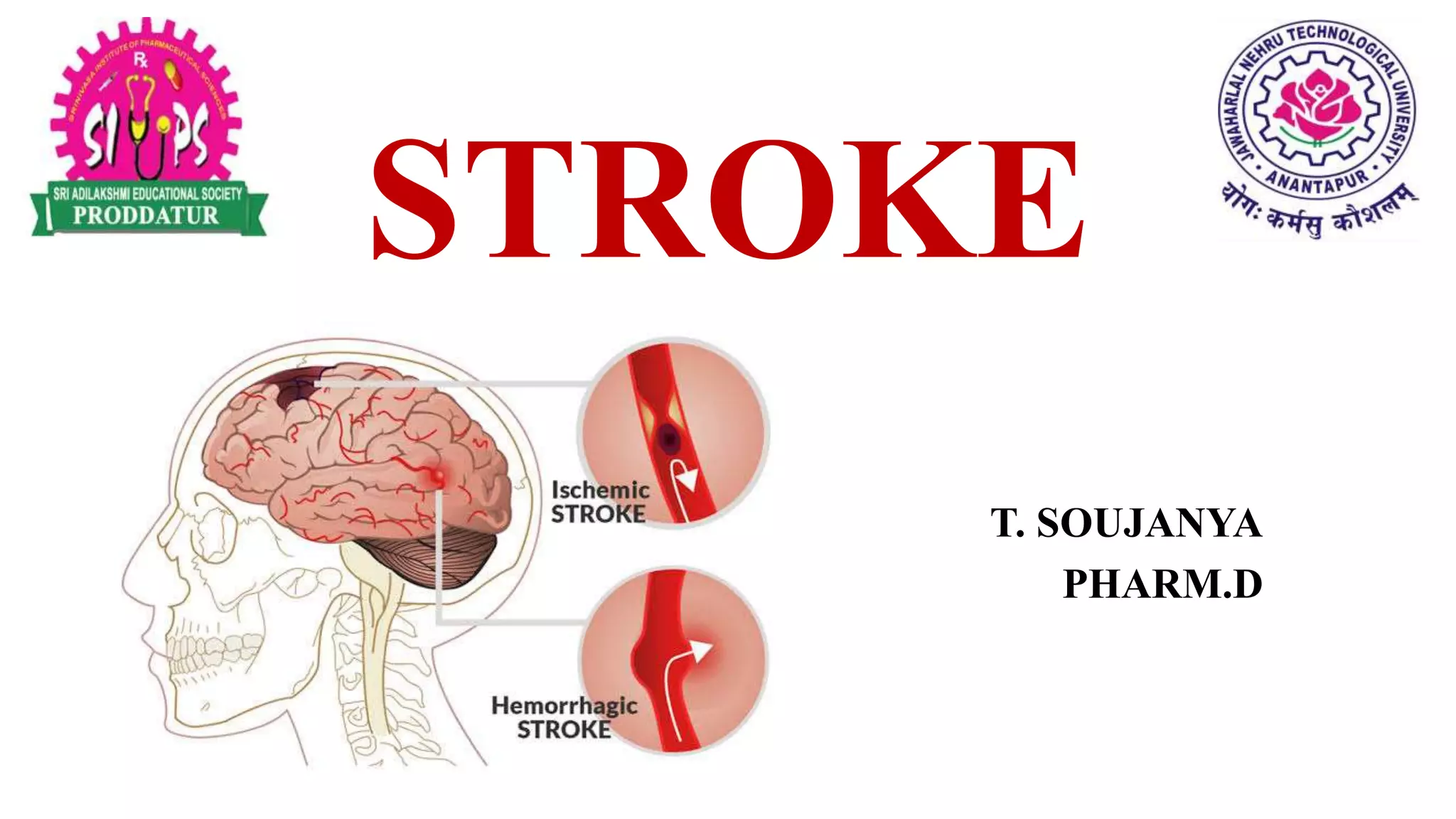 Classification, Pathophysiology and management of Brain Stroke for Pharm.D (Pharmacotherapeutics ...