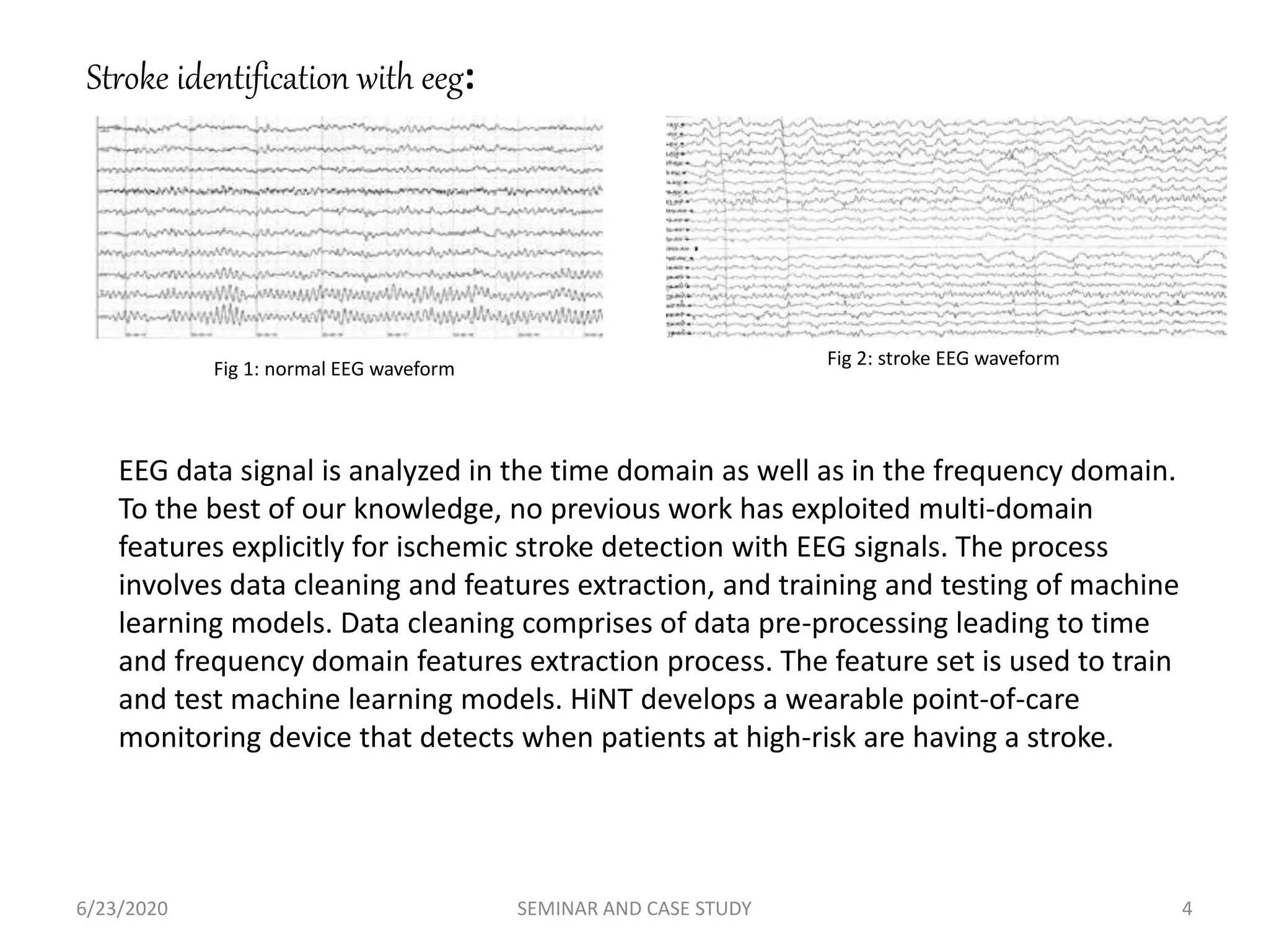 IDENTIFICATION AND IMPACT OF STROKE WITH EEG | PPTX