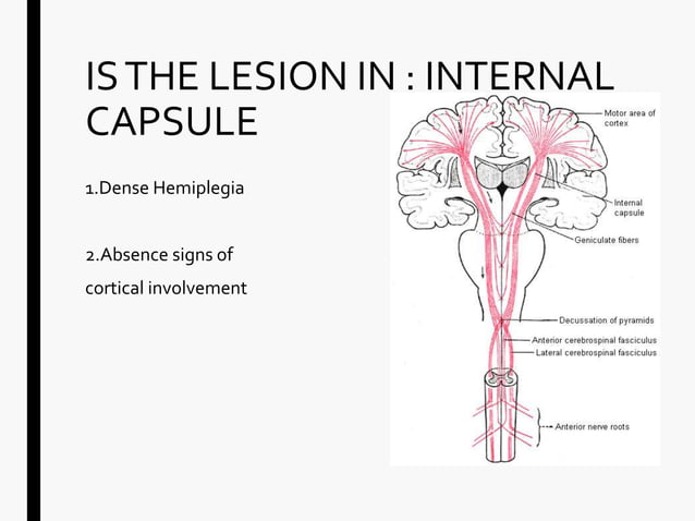 Stroke- CVA | PPT