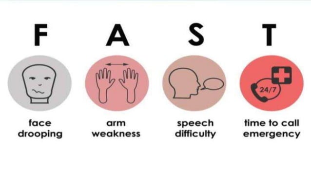 stroke presentation that covers every aspect of Focal neurological ...