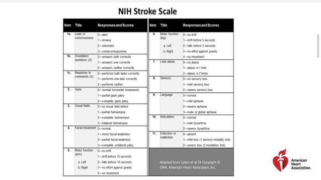 stroke presentation that covers every aspect of Focal neurological ...