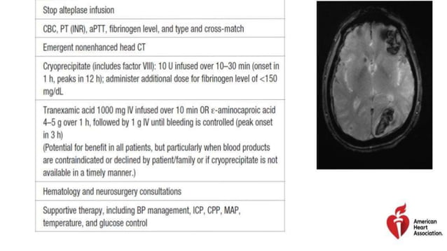 stroke presentation that covers every aspect of Focal neurological ...