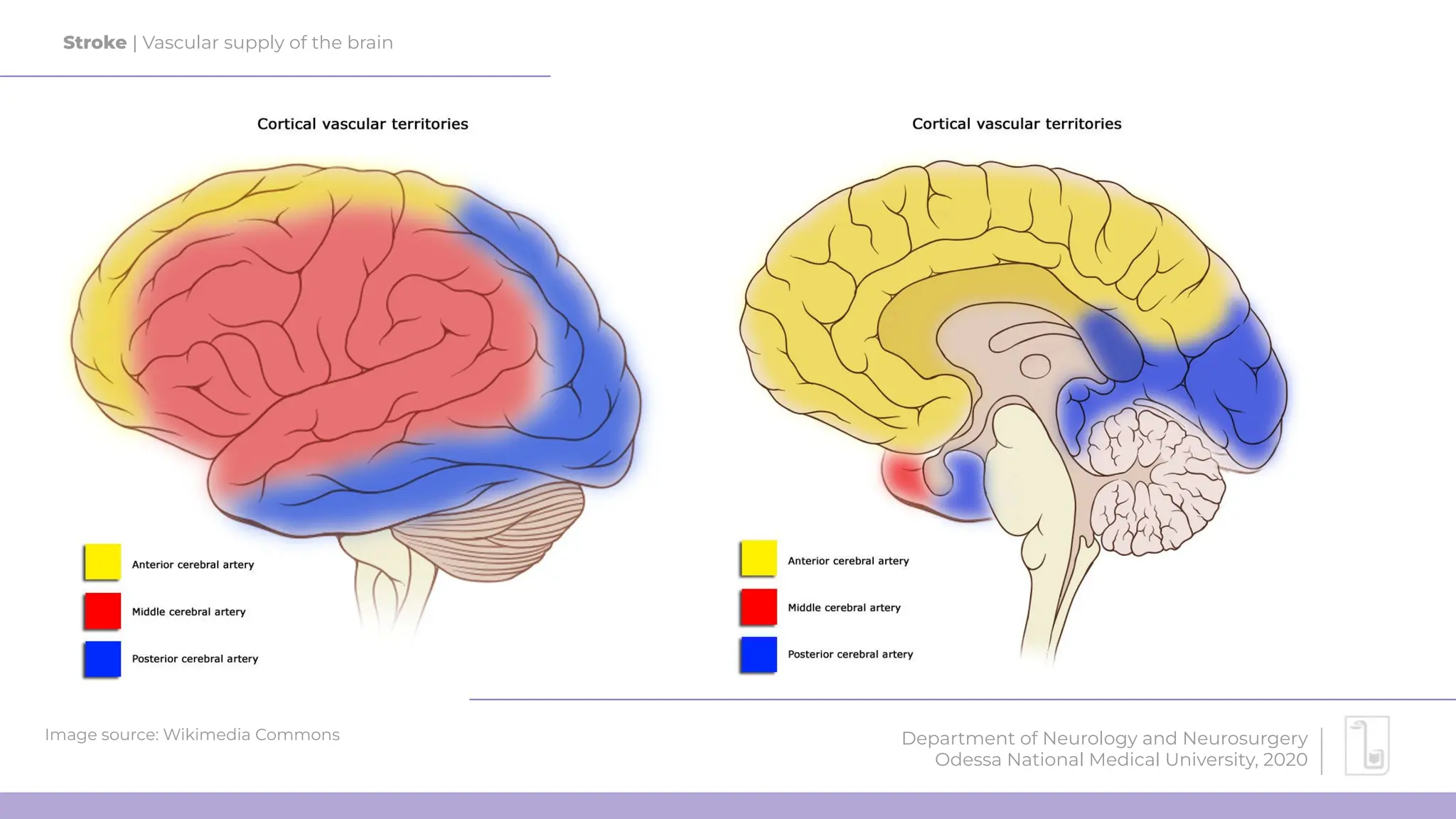 Stroke of different types.Hemorrhagic,Ischemic | PDF