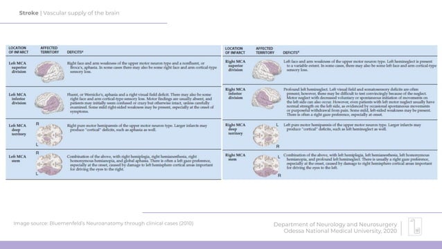 Stroke of different types.Hemorrhagic,Ischemic | PPT
