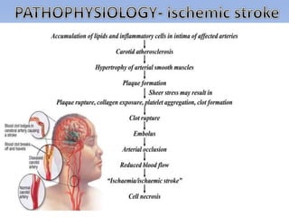 stroke.pptx cardio vascular accidents cvp | PPTX