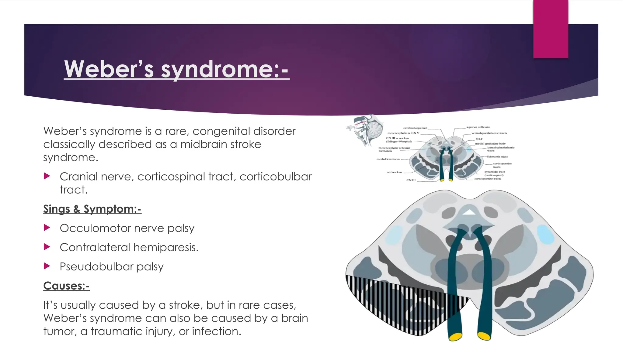 Stroke and stroke syndrome for physiotherapy.pptx