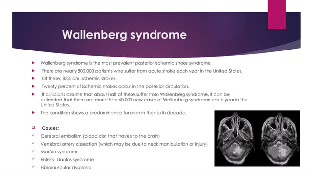 Stroke and stroke syndrome for physiotherapy.pptx