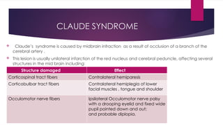 Stroke and stroke syndrome for physiotherapy.pptx