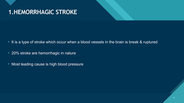 "Understanding Stroke: Causes, Symptoms, and Prevention" | PPT