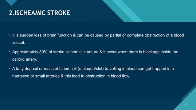 "Understanding Stroke: Causes, Symptoms, and Prevention" | PPT
