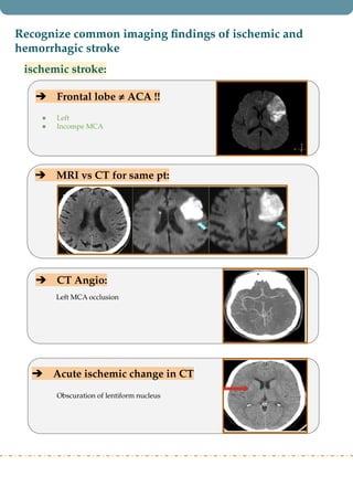 Pathophysiology of Stroke for pathology.pdf