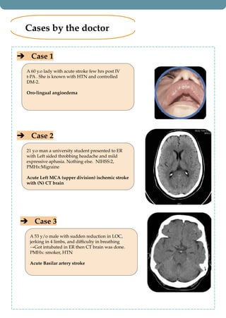 Pathophysiology of Stroke for pathology.pdf