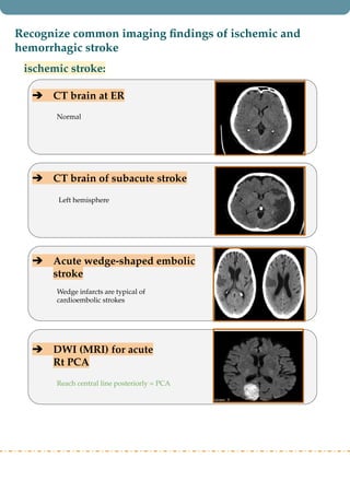 Pathophysiology of Stroke for pathology.pdf