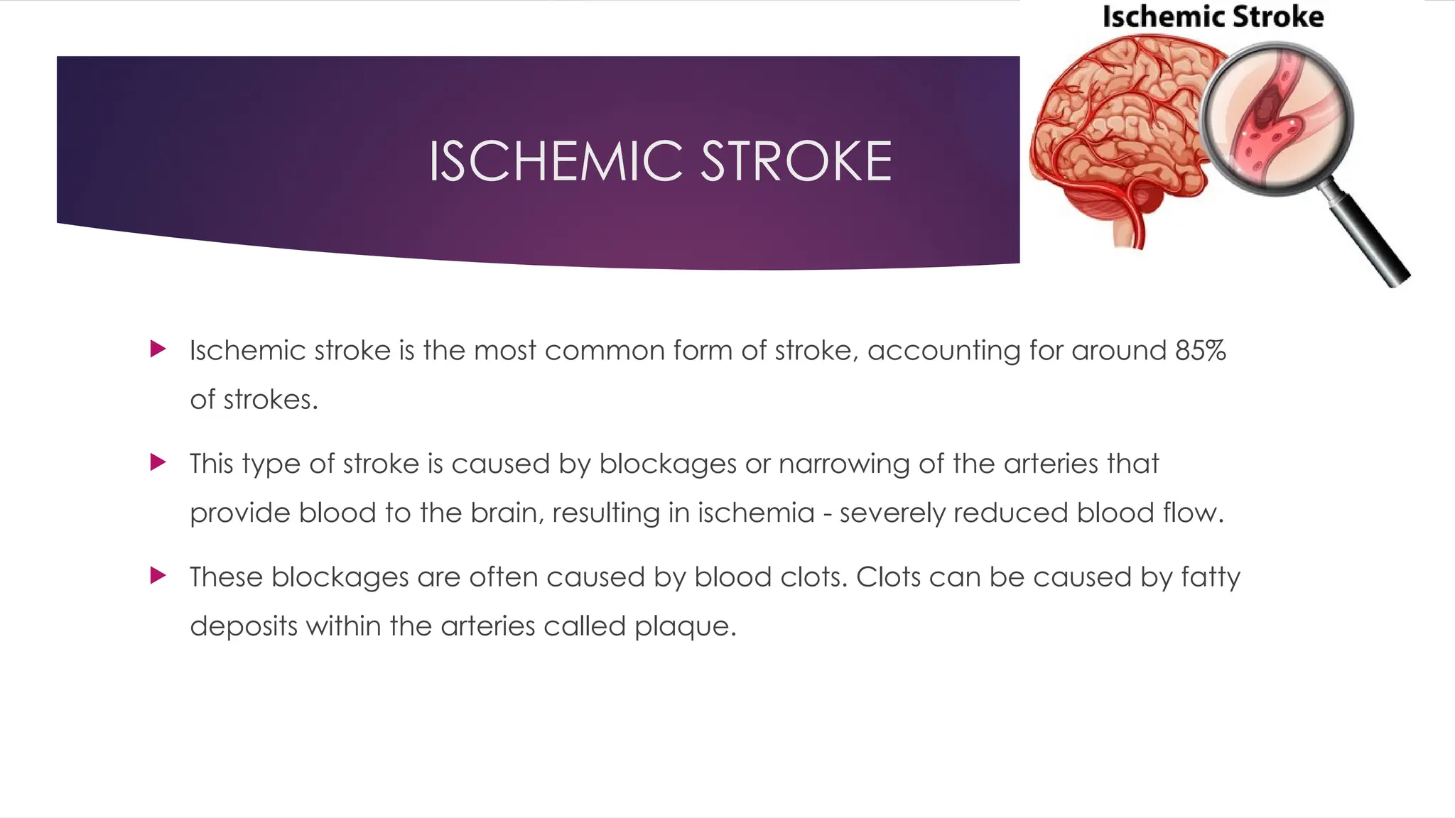 Stroke powerpoint presentation definition types | PPT