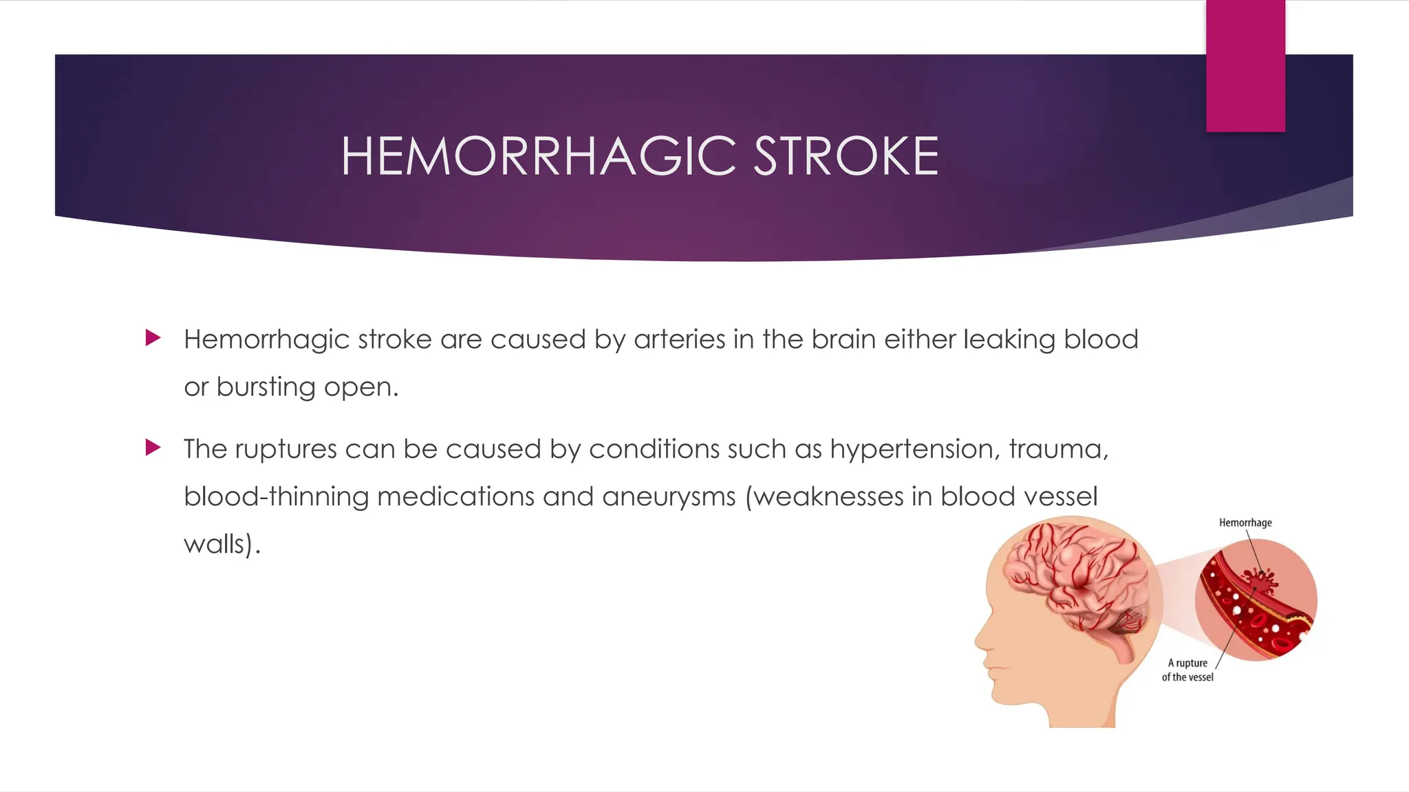 Stroke powerpoint presentation definition types | PPT