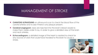 Stroke powerpoint presentation definition types | PPT