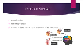 Stroke powerpoint presentation definition types | PPTX