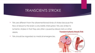 Stroke powerpoint presentation definition types | PPT
