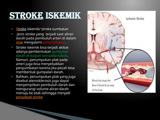 STROKE power point for penyuluhan prolanis | PPTX