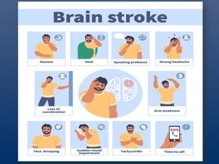 Brain stroke: Symptoms, Classification, prevention and management .pptx