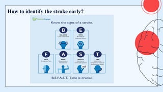 Stroke and its type - ischemic and haemorrhagic stroke by Dr Mahima ...