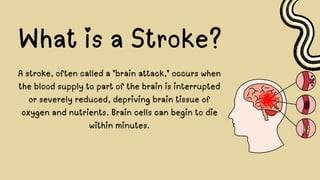 Troke, causes, parts of brain affected.pdf