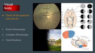 Stroke a clinical talk | PPT