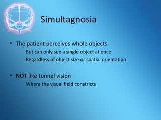 Stroke & Balint's syndrome | PPT