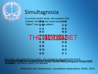 Stroke & Balint's syndrome | PPT