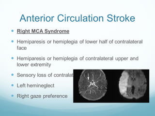 stroke-syndromes.pdf