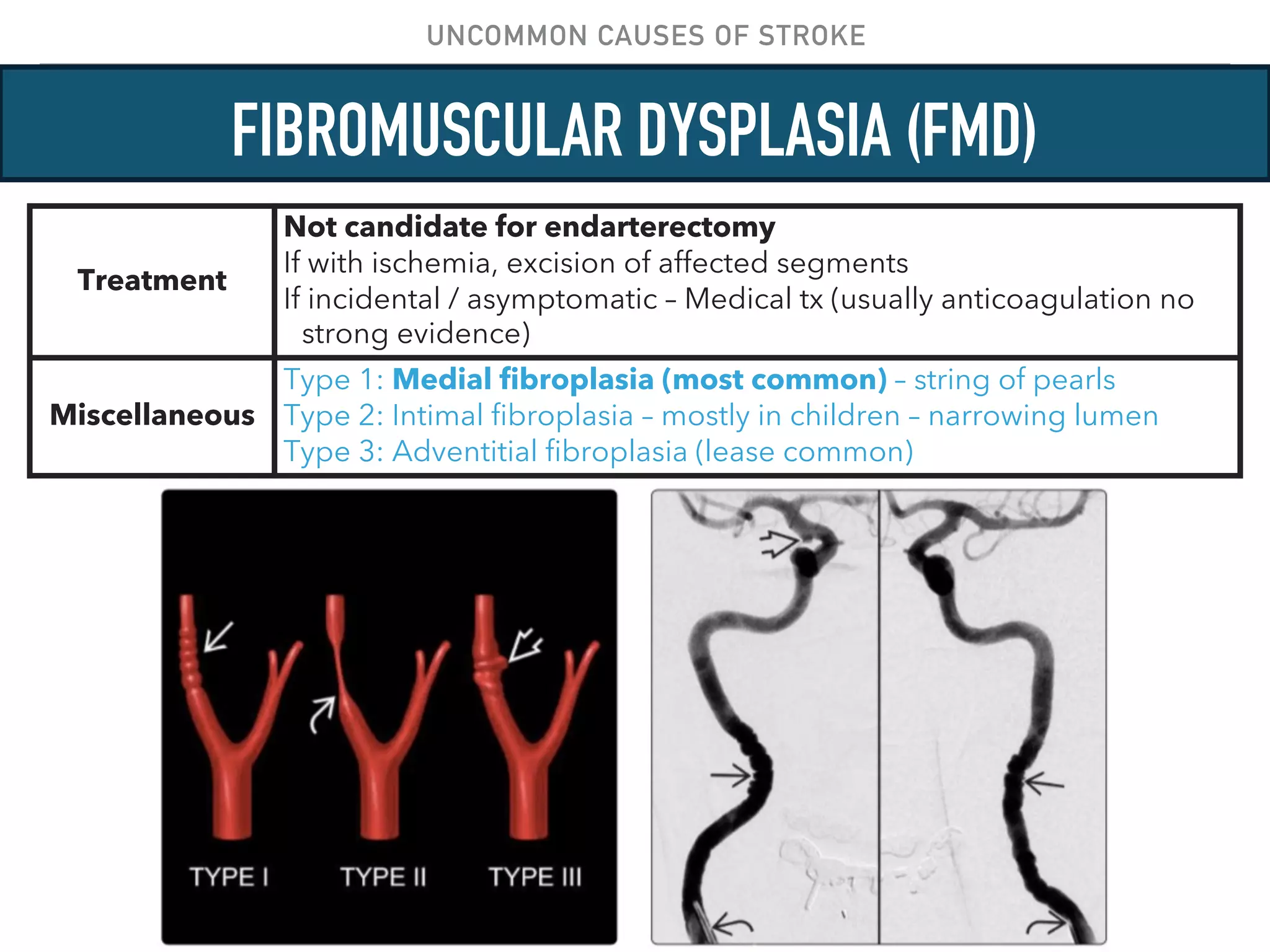 Stroke - Uncommon Causes of Stroke and Other CVD.pdf