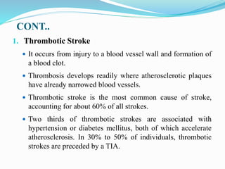 Stroke_024211.pptx