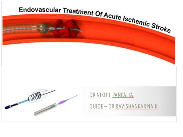 Endovascular treatment in acute cerebral ischemia | PPTX