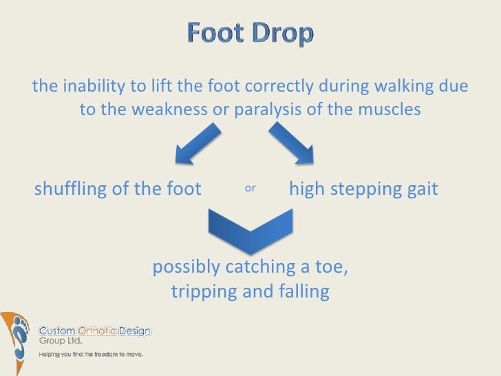 Stroke and Foot Drop treatment solutions