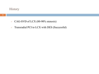 Stroke a rare complication in Post PCI patient | PPT